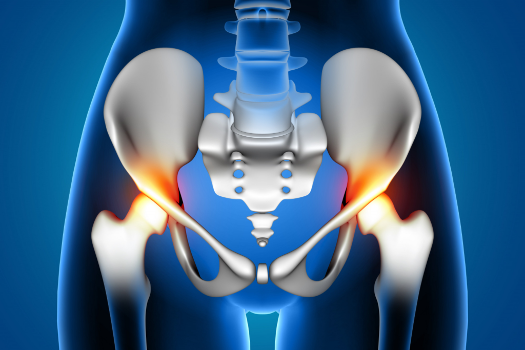 Sacroiliac Joint Blocks and Joint Injections - Cayman Islands